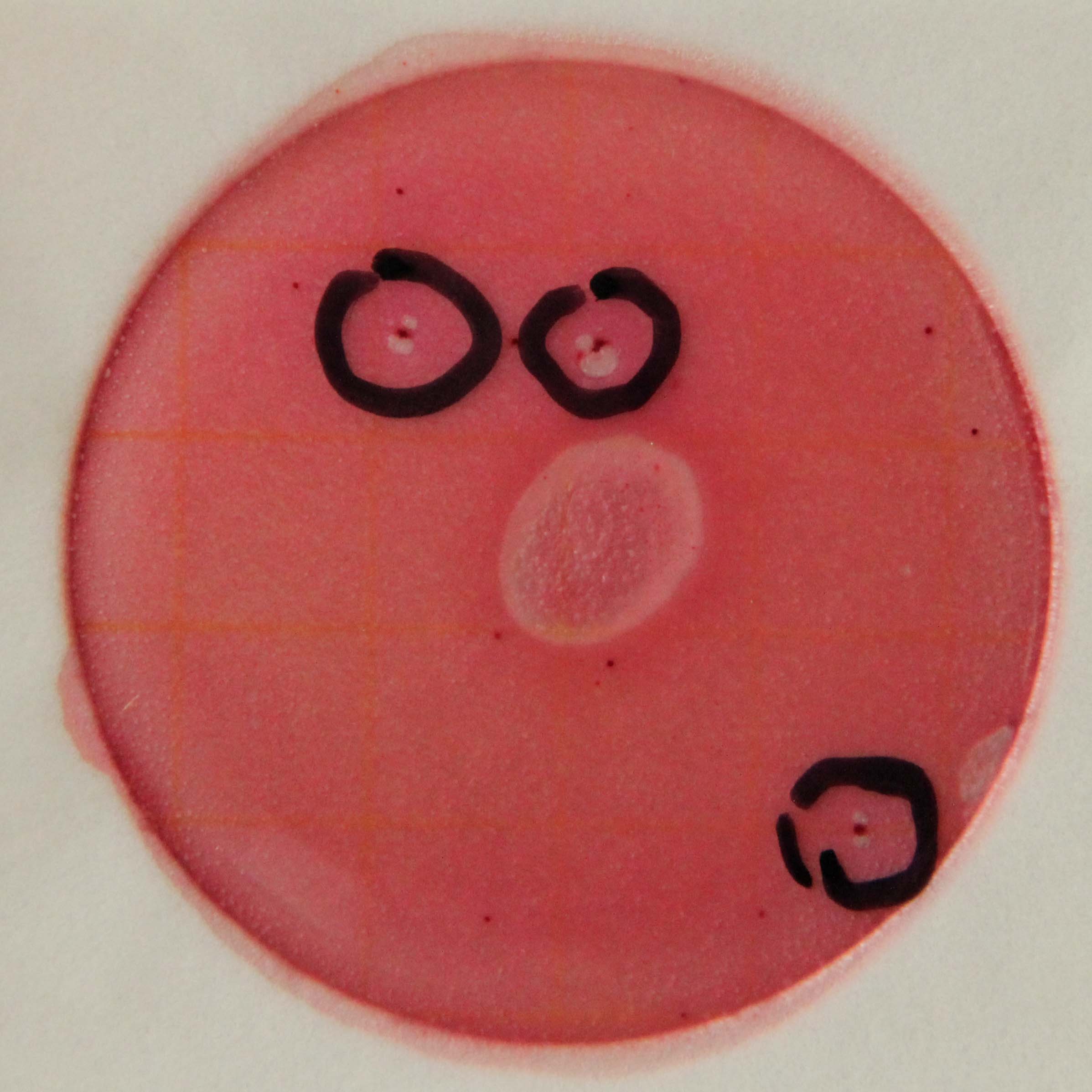 Chasing Coliform Counts | Gianaclis Caldwell